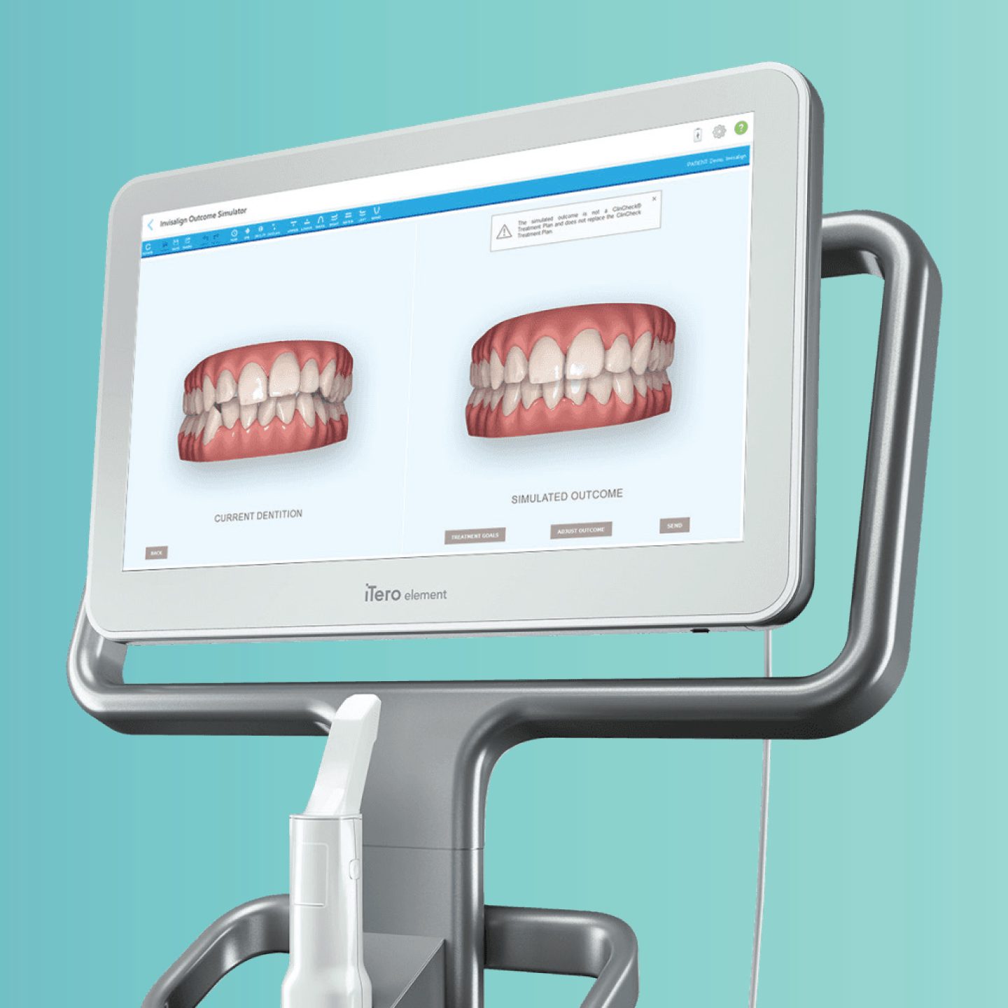 Custom Braces - HealthScope® Magazine